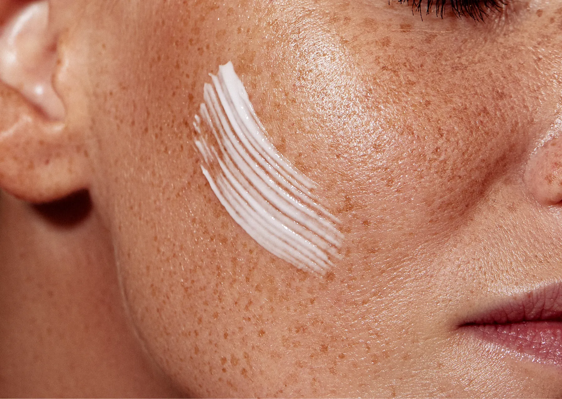 Hyperpigmentation : ma routine beauté pour s’en débarrasser